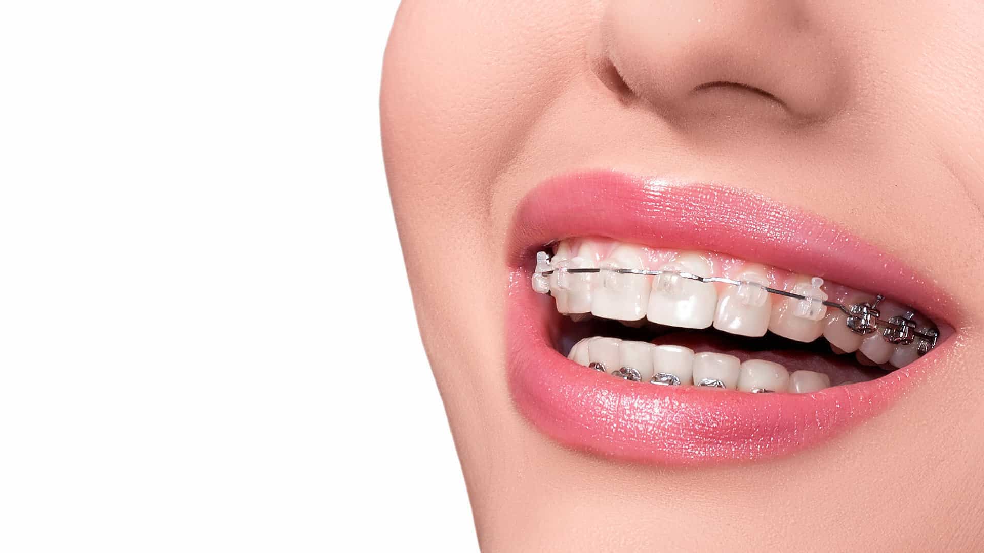 A&V Dental - Clínica Dental - Amamos Verte Sonreír